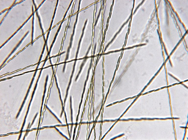 Amnesic Shellfish Poisoning – Harmful Algal Blooms