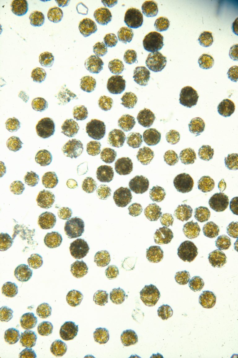 Alexandrium – Harmful Algal Blooms